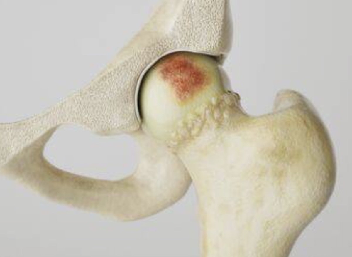 En hoe je het effectief aanpakt… | TrendingOnline